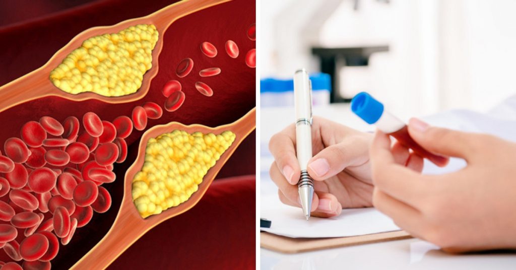 triglicerydy – Motywator Dietetyczny