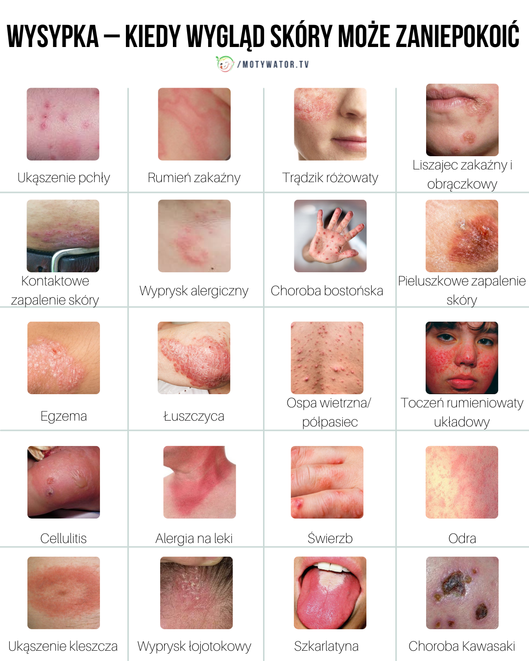 Wysypka – kiedy wygląd skóry może zaniepokoić. 20 najdziwniejszych ...